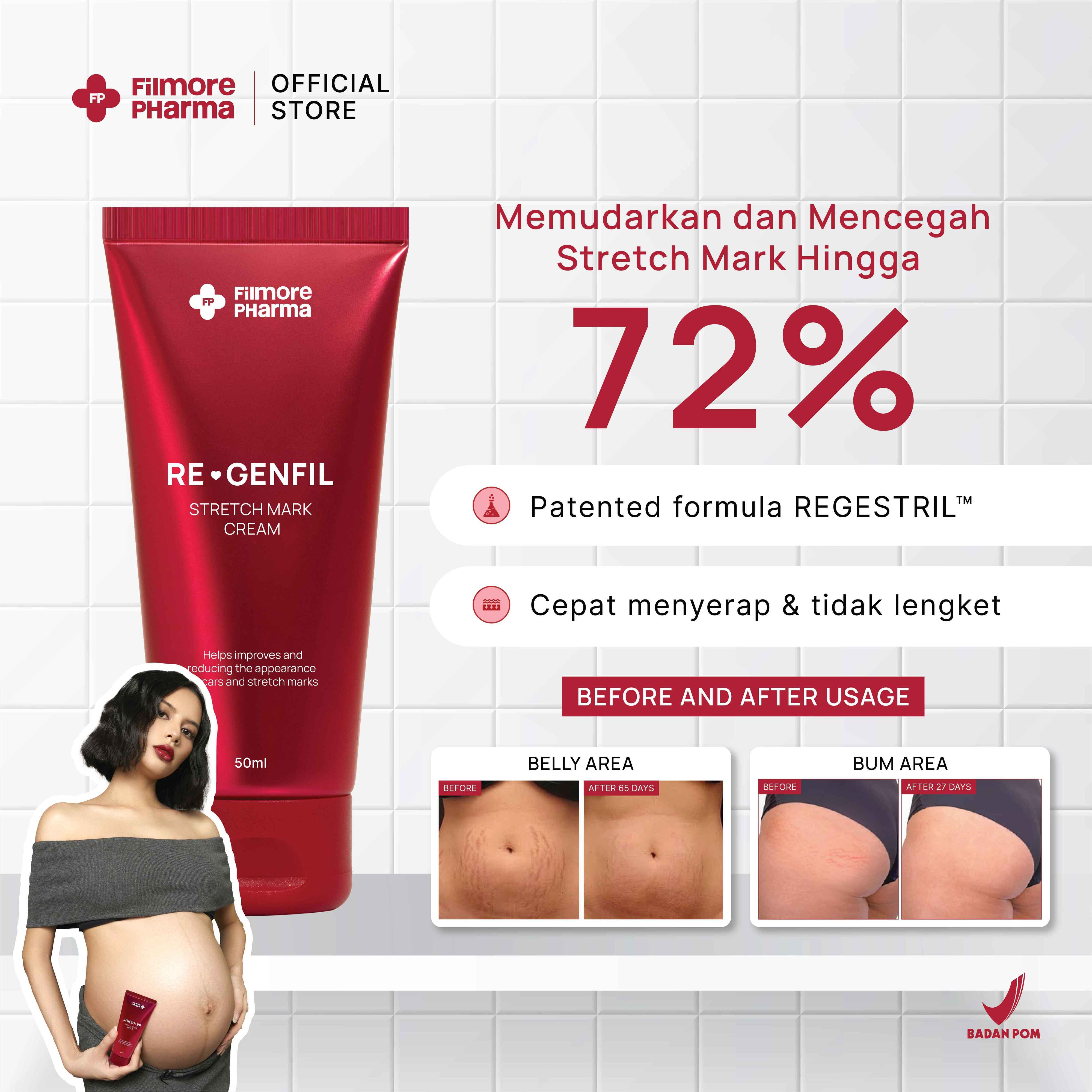 Filmore Regenfil Stretch Mark Cream with REGESTRIL™ – Filmore Pharma